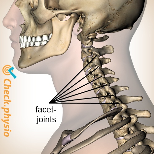 Cervical facet syndrome | Physio Check